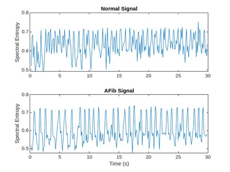 Classify Ecg Signals Using Long Short Term Memory Networks Matlab
