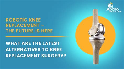 Other Options Than Knee Replacement At Callum Balmain Blog