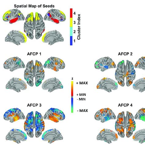 Resting State Functional Connectivity By Fnirs Hbr And Fmri Download Scientific Diagram