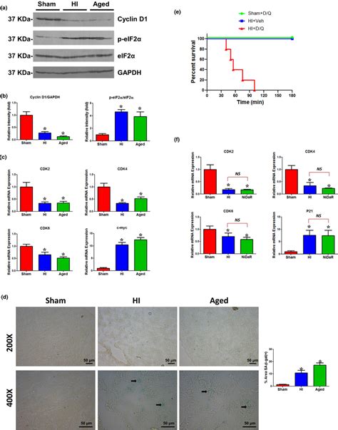 A Representative Immunoblotting Of Cyclin D1 P‐eif2α And Eif2α In