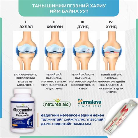 Өвдгөнд яс ургасан үед өвдөлт намдаах эмчилгээ “ЦАХИУР ТӨМӨР” ХХК