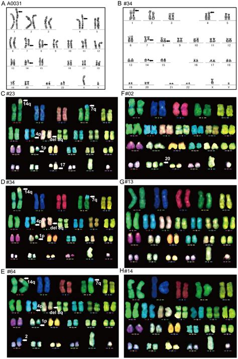 Karyotype Analysis Of Ws Ipscs Chromosomal Profiles Of G Band