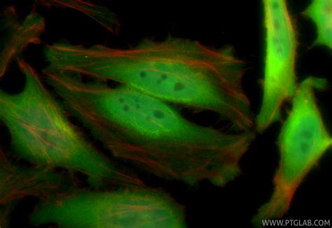 Cdkn2a P16 Ink4a Antibody 81373 10 Pbs Proteintech 武汉三鹰生物技术有限公司
