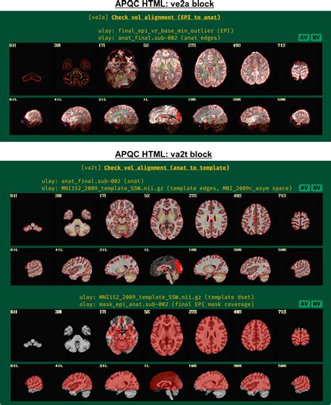 Question About First Level Analysis In Afni And Fmriprep Preprocessing Fmriprep Neurostars