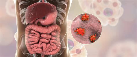 Amebiasis Amoebic Dysentery Signs Symptoms And How Its Treated