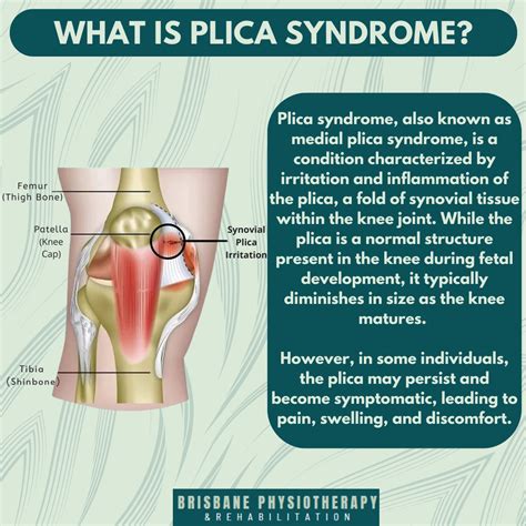 What Is Plica Syndrome Brisbane Physiotherapy And Podiatry