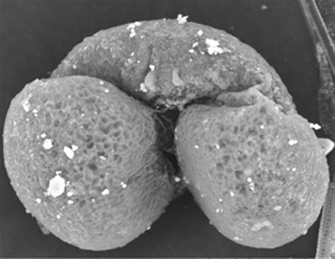 Pine Pollen Earth Sciences New Zealand Niwa