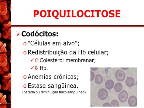 Histologia90 AlteraÇÕes EritrocitÁrias