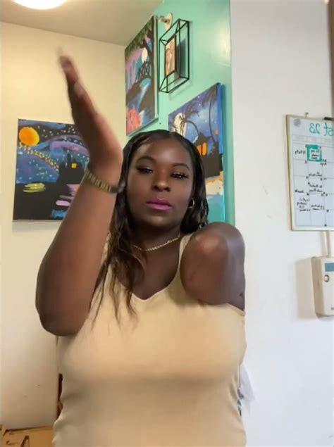 A Woman With One Upper Arm Amputation