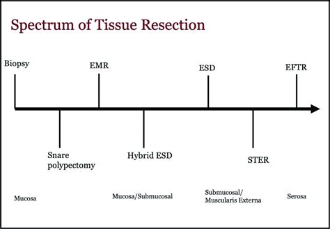 Advanced Tissue Resection In Gastroenterology Indications Role And Outcomes Mdedge