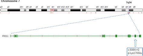Schematic Representation Of The Structure Of Prss1 Cdna Mutation And
