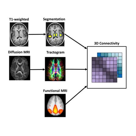 Classification Of Parkinsons Disease Using Ai Based On Multi Modal Brain Mri Connectomics Mds