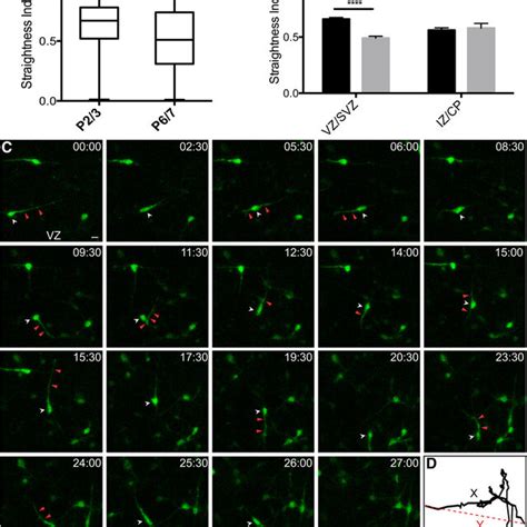 Cortical Plate Directed Radial Migration Of Ferret Neurons Decreases Download Scientific