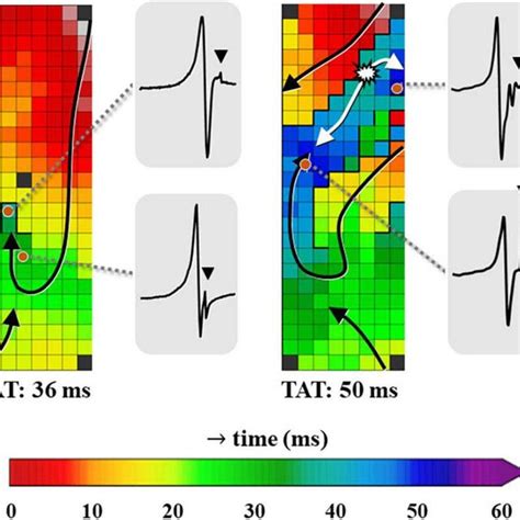 Four Examples Of Color Coded Activation Maps Containing Loms Derived