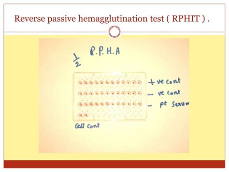 Ppt Practical 3 Serological Techniques Powerpoint Presentation Free