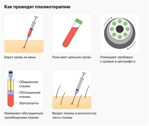 Алопеция у мужчин: причины, типы, лечение мужского облысения