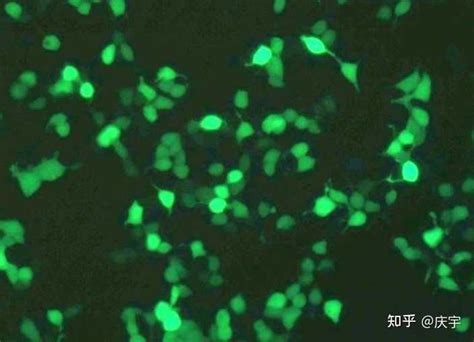 亚细胞定位，荧光蛋白表达的问题？ 知乎