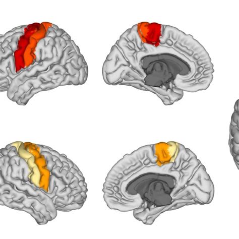 Eloreta Localization Of Csp Patterns Presented In Figure 5 With Download Scientific Diagram