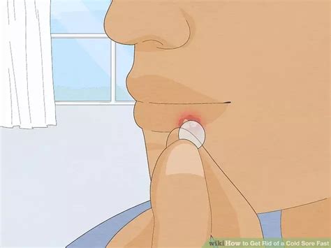 Ways To Get Rid Of A Cold Sore Fast Artofit Ways To Get Rid Of A Cold Sore Fast Artofit