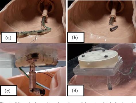 Figure 1 From An Endoluminal Robotic Platform For Minimally Invasive Surgery Semantic Scholar