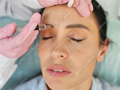 A Woman Receives A Botox Injection On Her Forehead At A Clinic Concept 이미지 2187788043 게티이미지뱅크