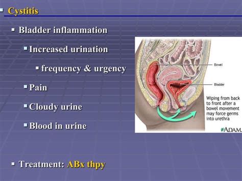 Urinary Patho 2014 Ppt