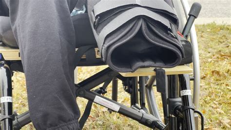 Manitoba Man Recounts Waking Up To Find Wrong Leg Amputated