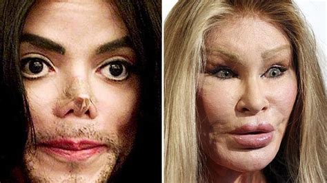 Who Has The Best Celebrity Plastic Surgery And What Can You Learn From