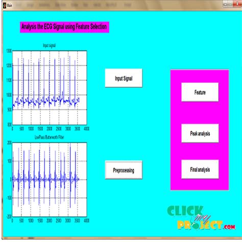 Electrocardiogram Signal Modeling With Adaptive Parameter Estimation