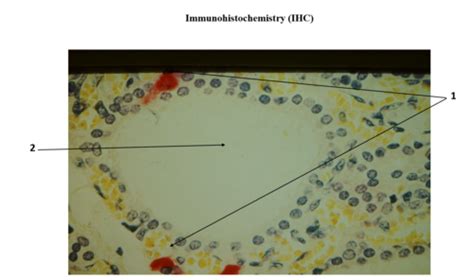 Endcocrine Lab Flashcards Quizlet