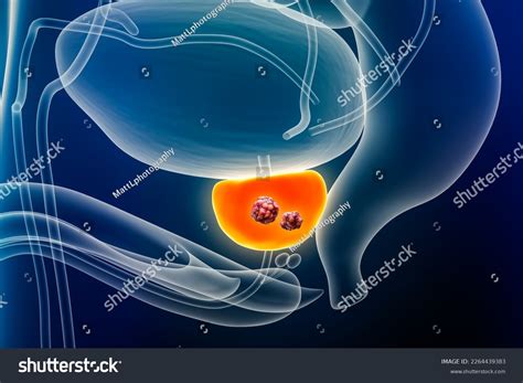Prostate Cells