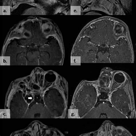 Prathamesh Pai Professor Tata Memorial Centre Mumbai Tmc Head