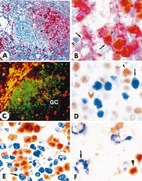 Double Stained GC Of Normal Tonsil Paraffin Sections A Double Download Scientific Diagram