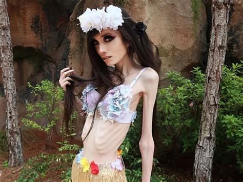 Youtuber Eugenia Cooneys Skinny Appearance Triggers 911 Calls