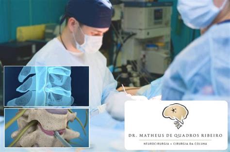 Microdiscectomia cervical - Dr. Matheus de Quadros Ribeiro
