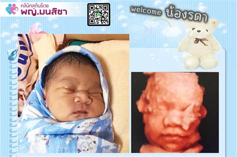 🎉 ยินดีต้อนรับ “น้องรดา” นะคะ 🎉 🎀 อัลตราซาวน์ 3 มิติ 4 มิติ ทำให้พ่อแม่สามารถเห็นลูกน้อยได้