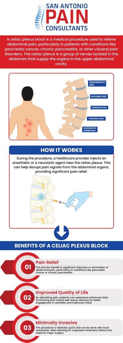 Celiac Plexus Block Treatment Specialist In San Antonio Tx
