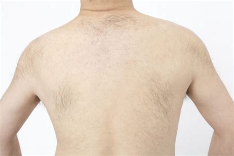 Best Hair Removal Laser For Men In Bedford The Ryder Clinic