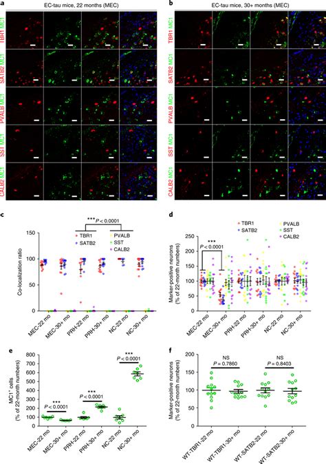 Excitatory And Inhibitory Neurons Are Differentially Vulnerable To Tau