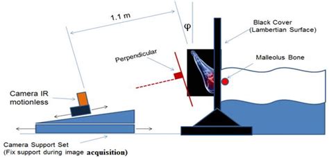 Figure From Early Diagnostic Of Diabetic Foot Using Thermal Images Semantic Scholar
