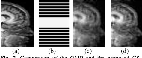 Figure 2 From A Novel Compressive Sampling Mri Method Using Variable Density K Space Under