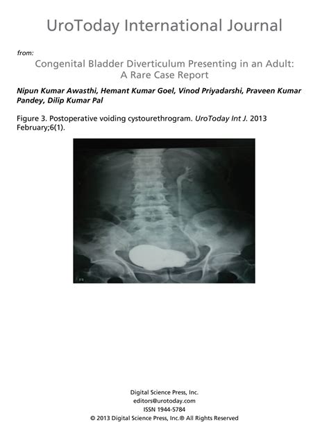 Congenital Bladder Diverticulum Presenting In An Adult A Rare Case Report