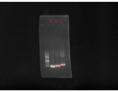 220 Questions With Answers In Plasmid Extraction Scientific Method