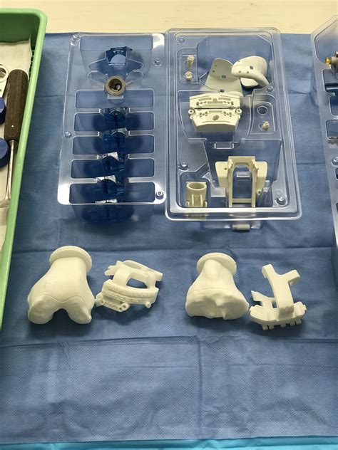 How Long Does A Total Hip Or Knee Replacement Last Dr Chien Wen Liew