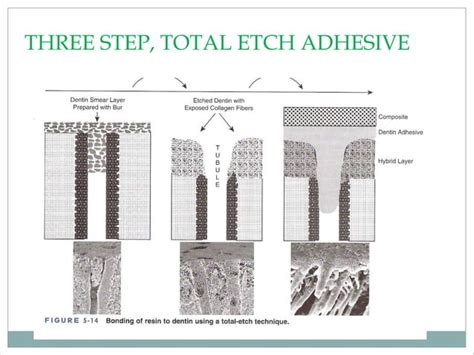 Dentin Bonding Agent Pdf Dental Health Diseases And Conditions