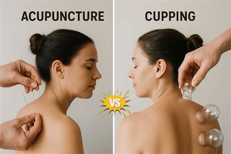 Acupuncture Vs Cupping Which Therapy Works Best For You