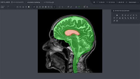 Keymakr Data Labeling On Linkedin Navigating The Future Of Ai The Vital Role Of Image