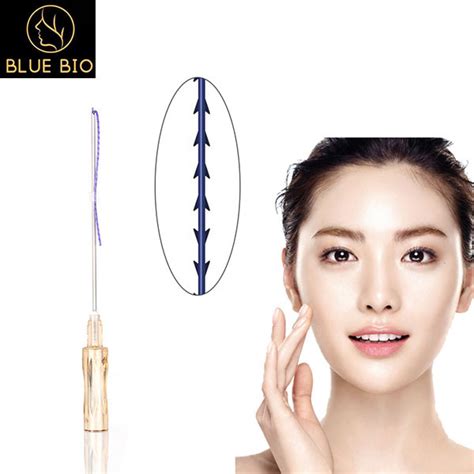 Fishbone Pdo Thread 18g 120mm Suture Threads With Needle For Facial Shaping