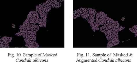 Figure 10 From Bacteria Classification Using Image Processing And Deep Convolutional Neural