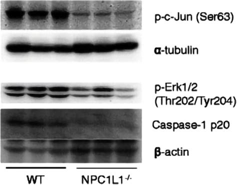 The Role Of Npc1l1 In Cancer Pmc